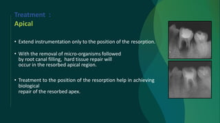 INTERNAL ROOT RESORPTION AND ITS CLINICAL MANAGEMENT | PPTX