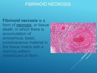 Irreversible cell i njury | PPTX