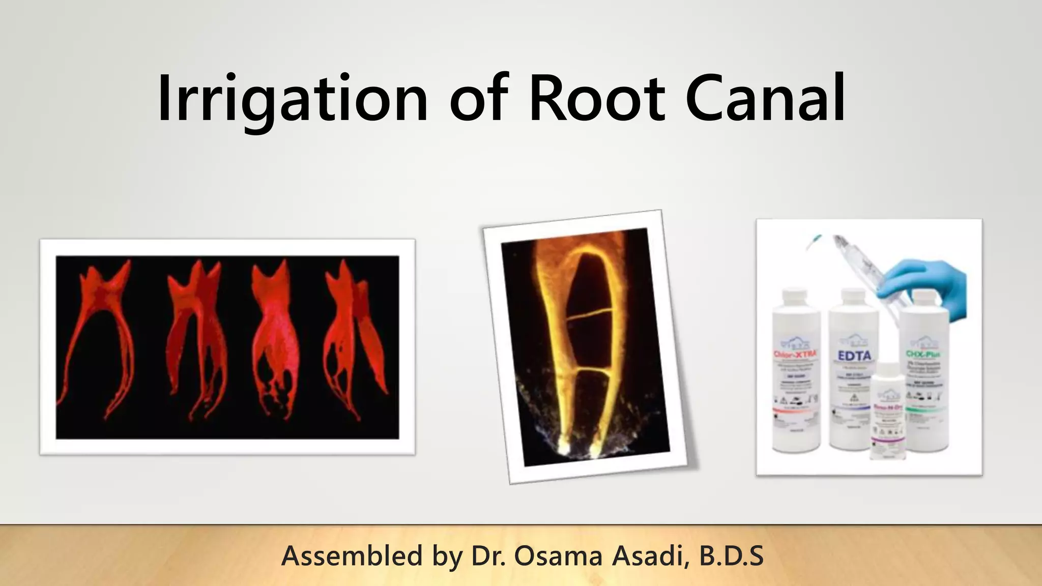 Root Canal Irrigation During Endodontic Treatment | PPTX