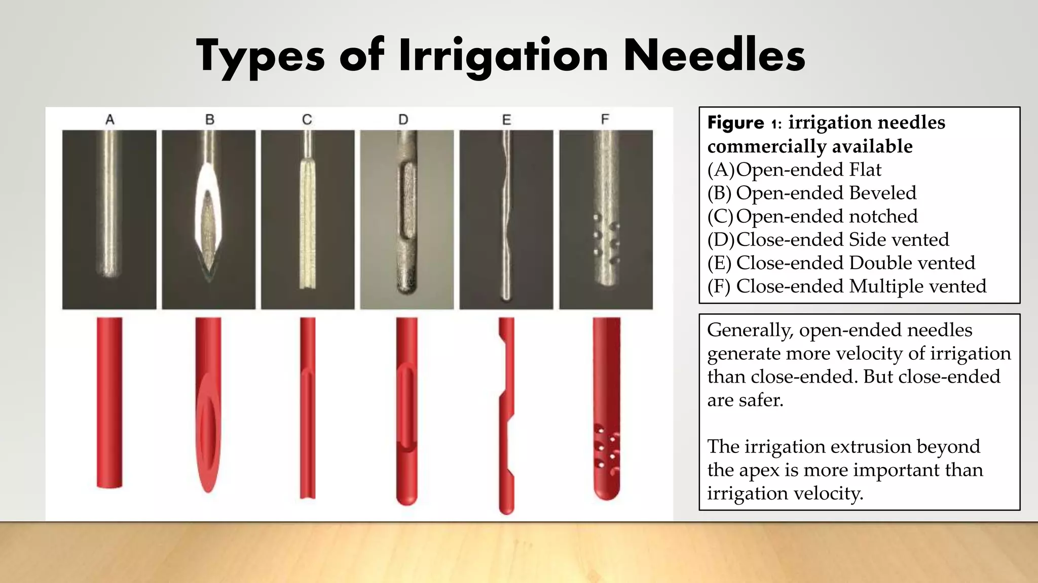 Root Canal Irrigation During Endodontic Treatment | PPTX