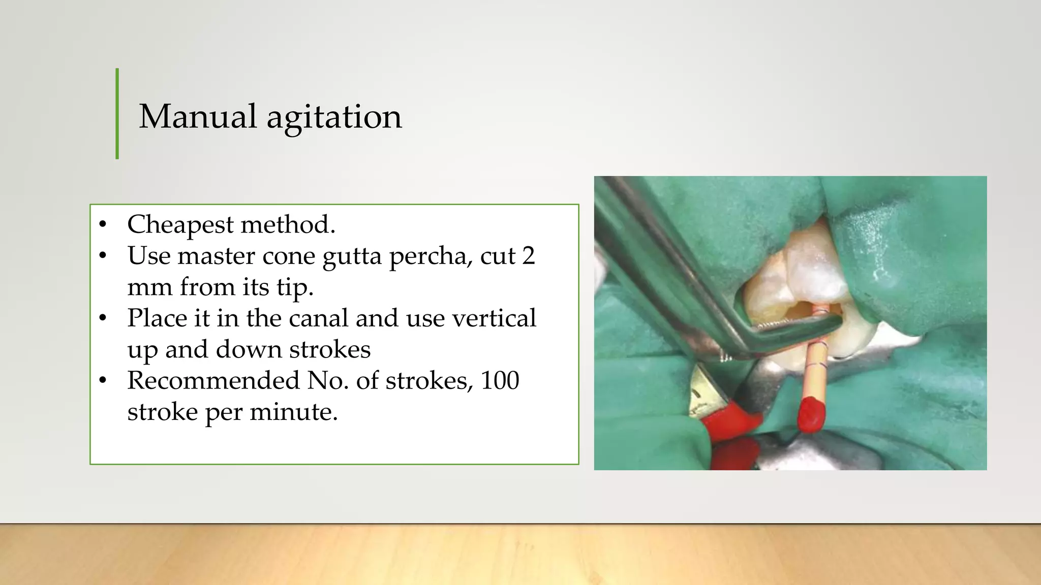 Root Canal Irrigation During Endodontic Treatment | PPTX