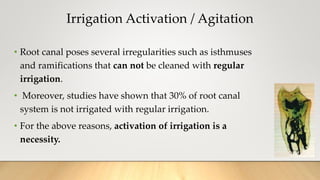 Root Canal Irrigation During Endodontic Treatment | PPTX