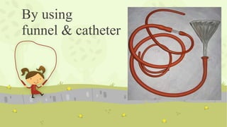 Irrigation of medication | PPTX