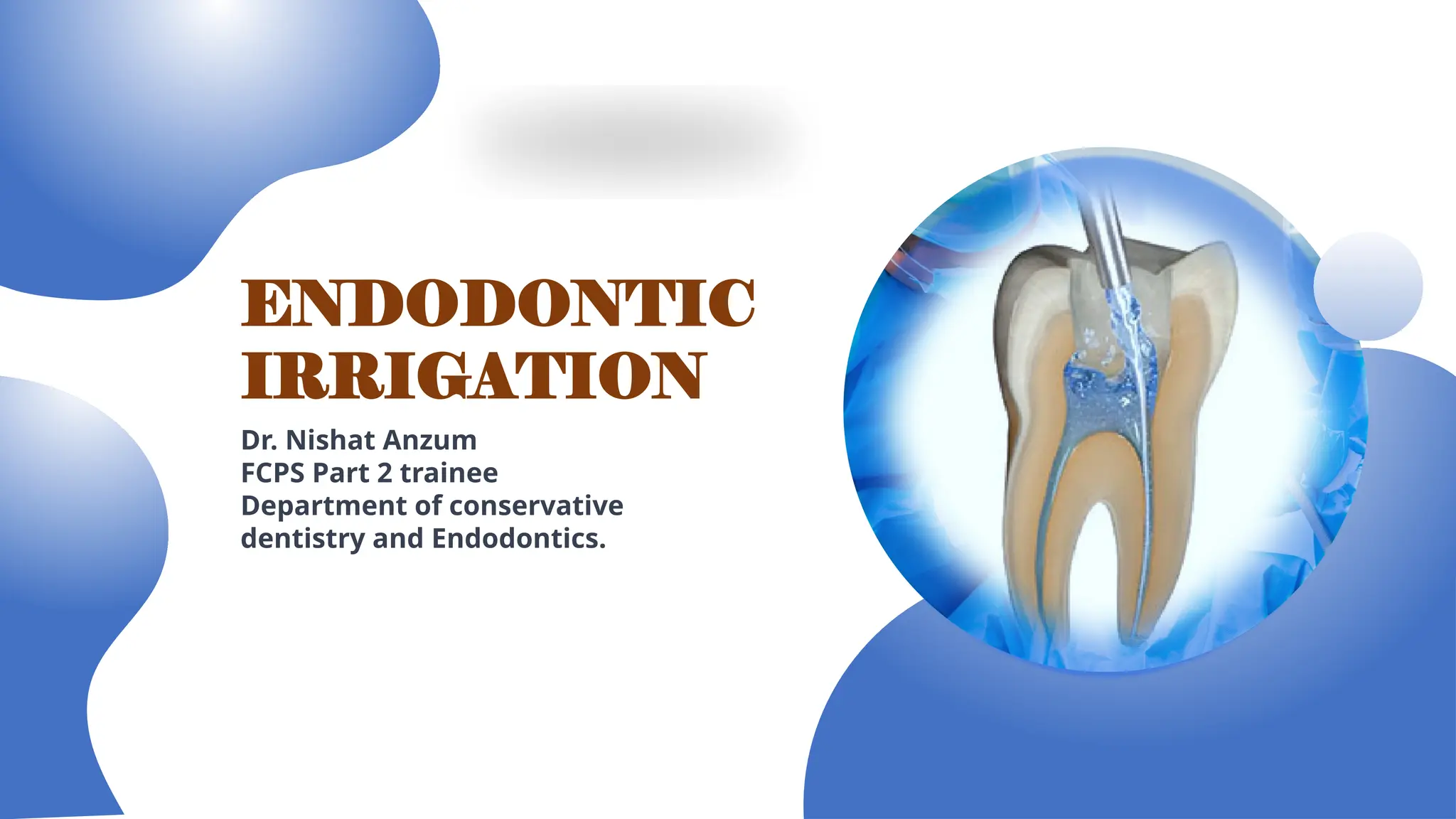 Irrigation Solutions in Endodontics: Types, Techniques, and Best Practices | PPTX