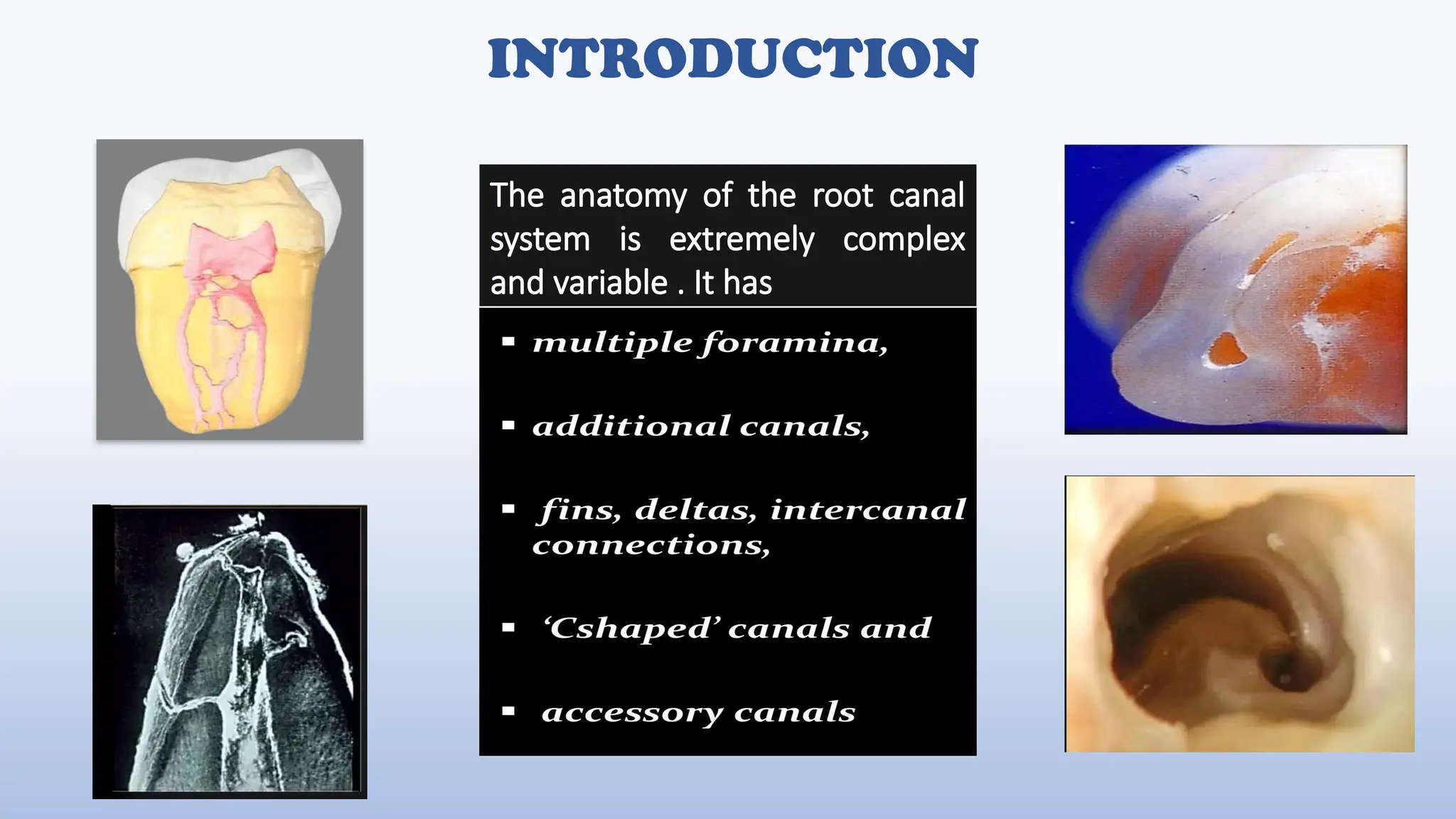 Irrigation Solutions in Endodontics: Types, Techniques, and Best ...