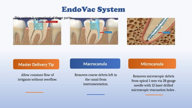 Irrigation Solutions in Endodontics: Types, Techniques, and Best ...
