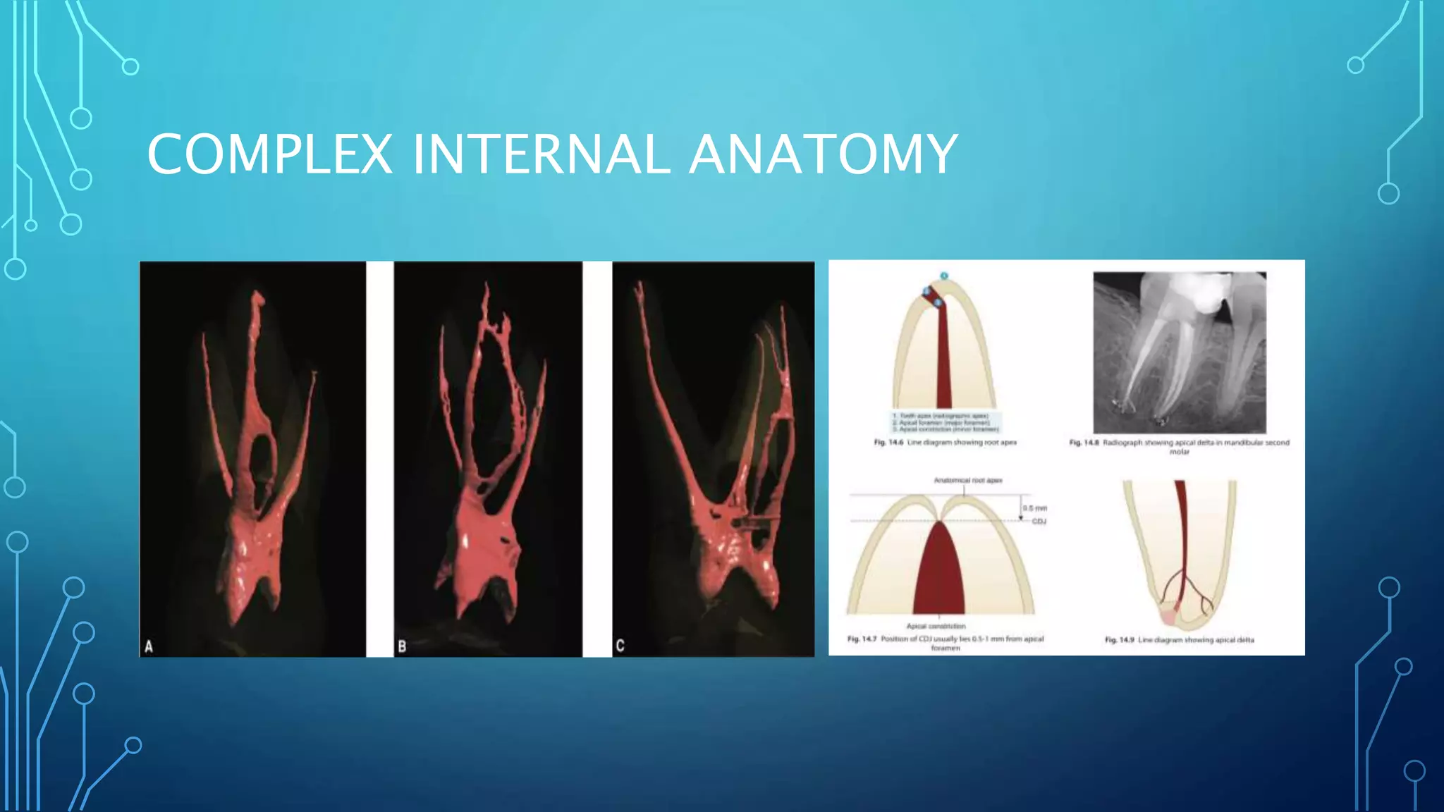 Root canal irrigation.pptx