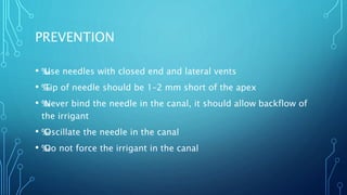 Root canal irrigation.pptx