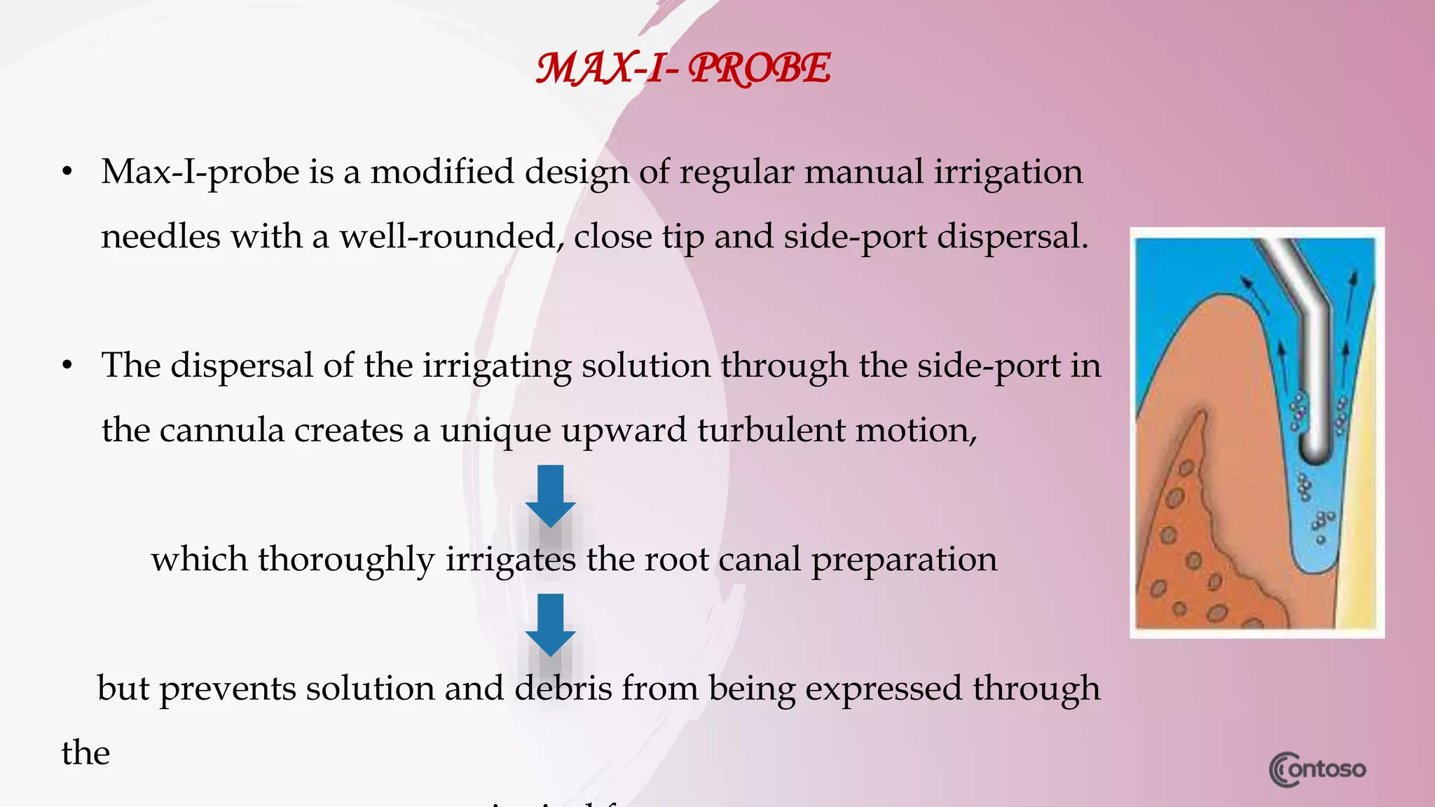 Irrigation agitation techniques | PPTX