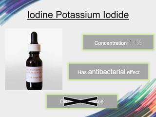 Irrigation in endodontic | PPTX