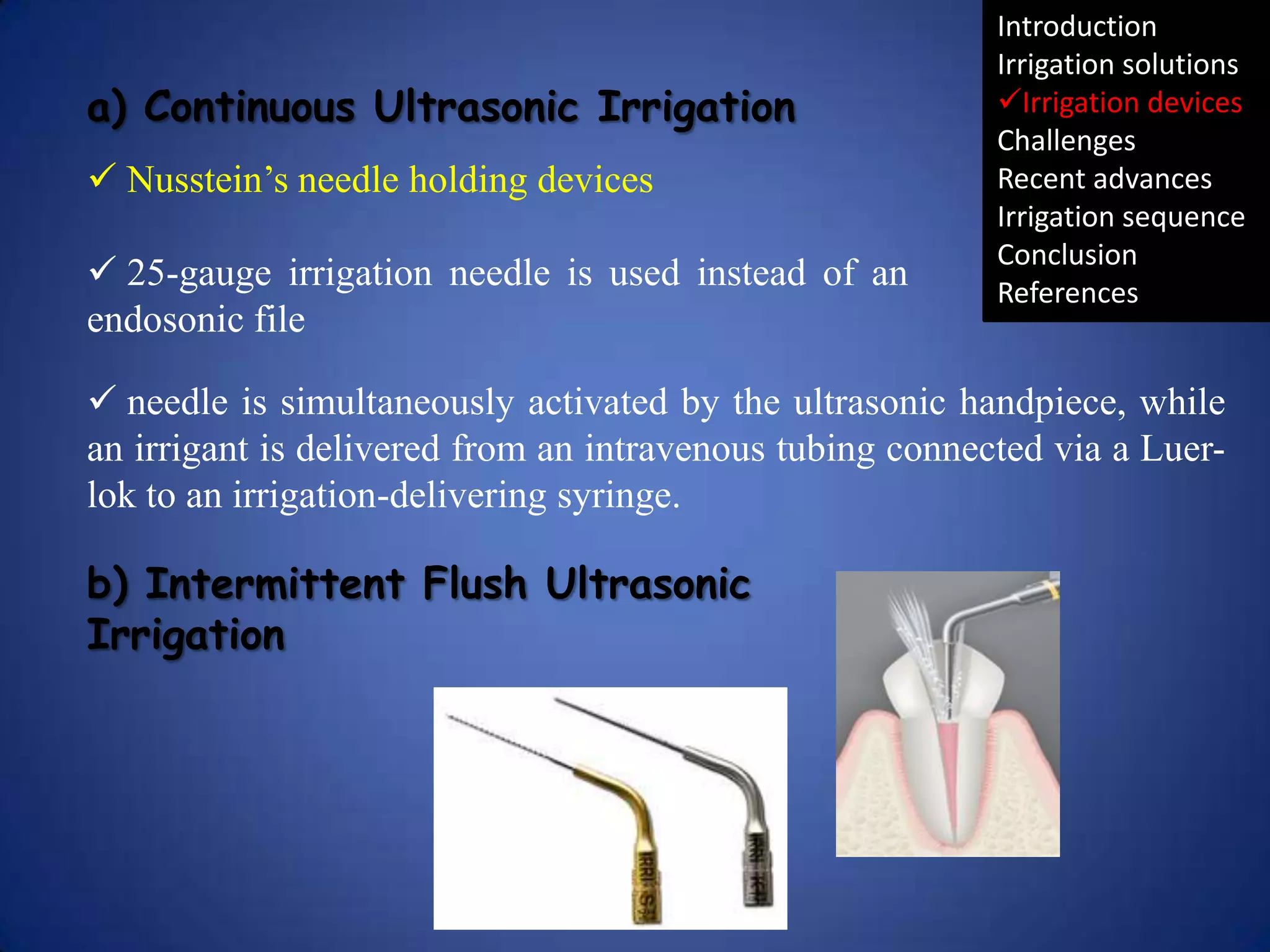 Irrigation in endodontics | PPTX