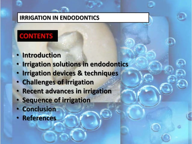 Irrigation in endodontics | PPTX