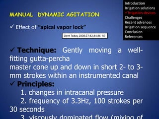 Irrigation in endodontics | PPTX