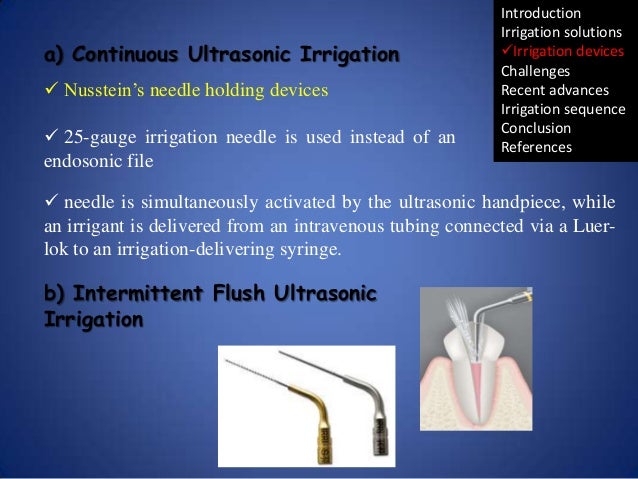 Irrigation in endodontics