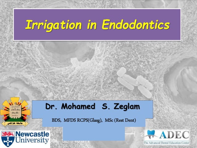 Irrigation in endodontics | PPTX | Dental Health | Diseases and Conditions