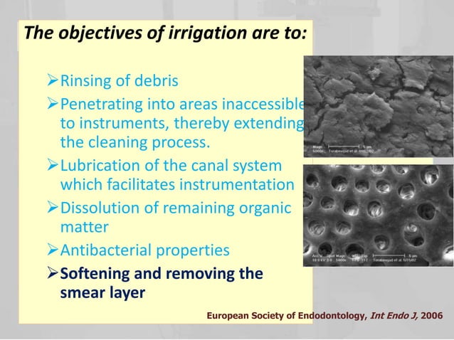Irrigation in endodontics | PPTX | Dental Health | Diseases and Conditions