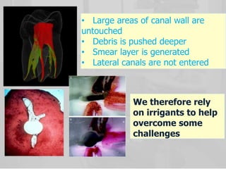 Irrigation in endodontics | PPTX