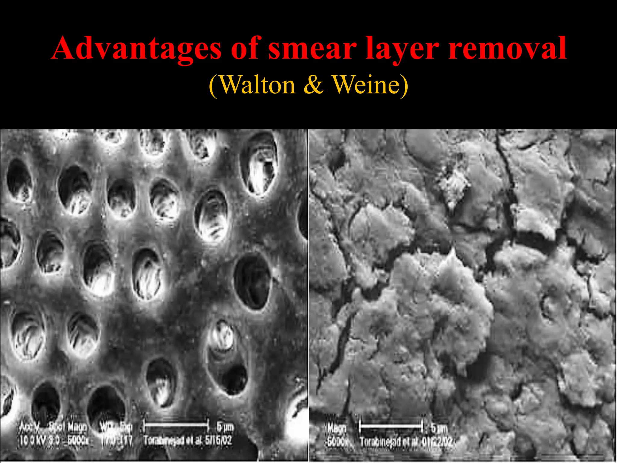 Irrigation in Endodontics.pdf