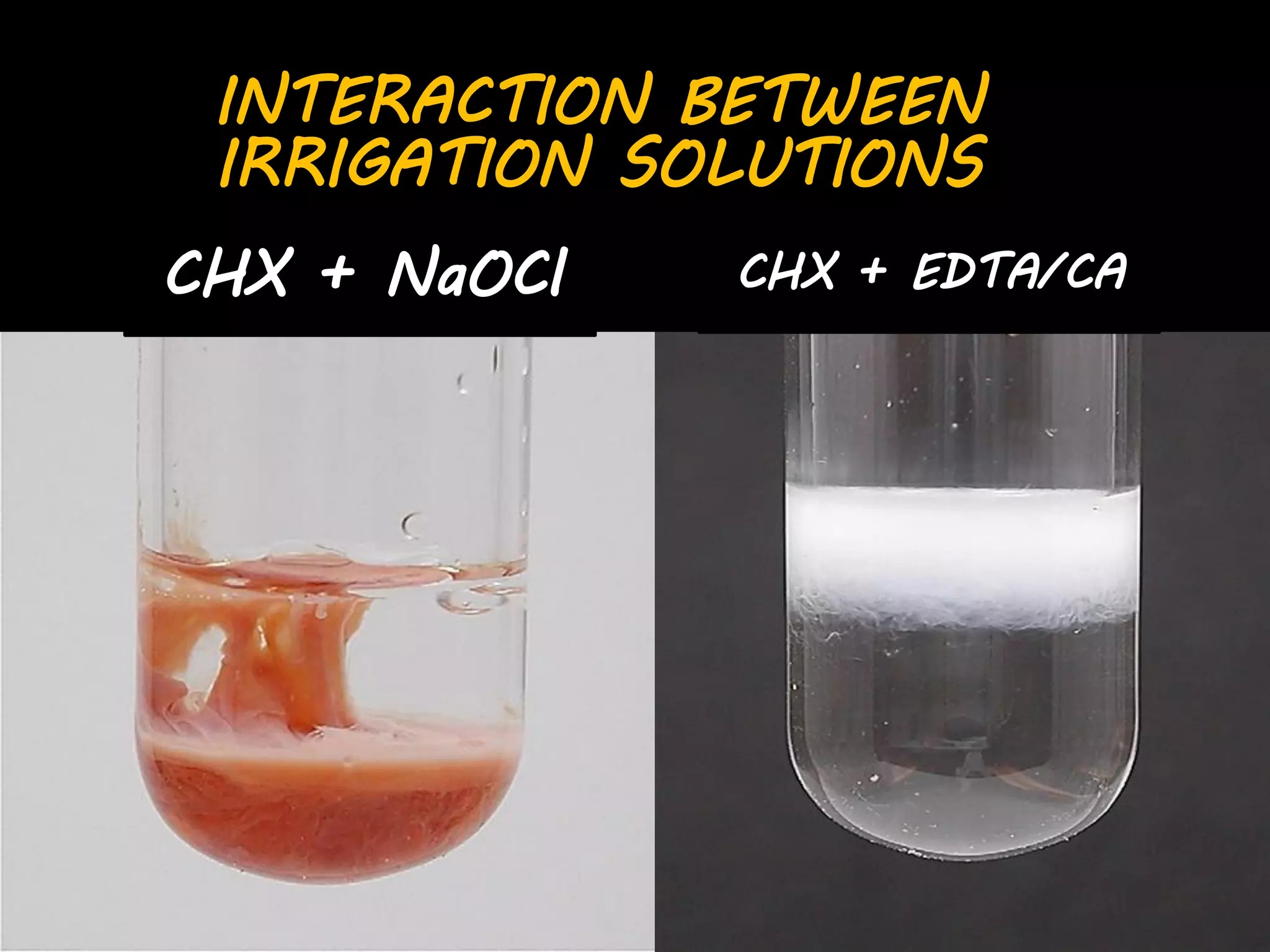 Irrigation in Endodontics.pdf