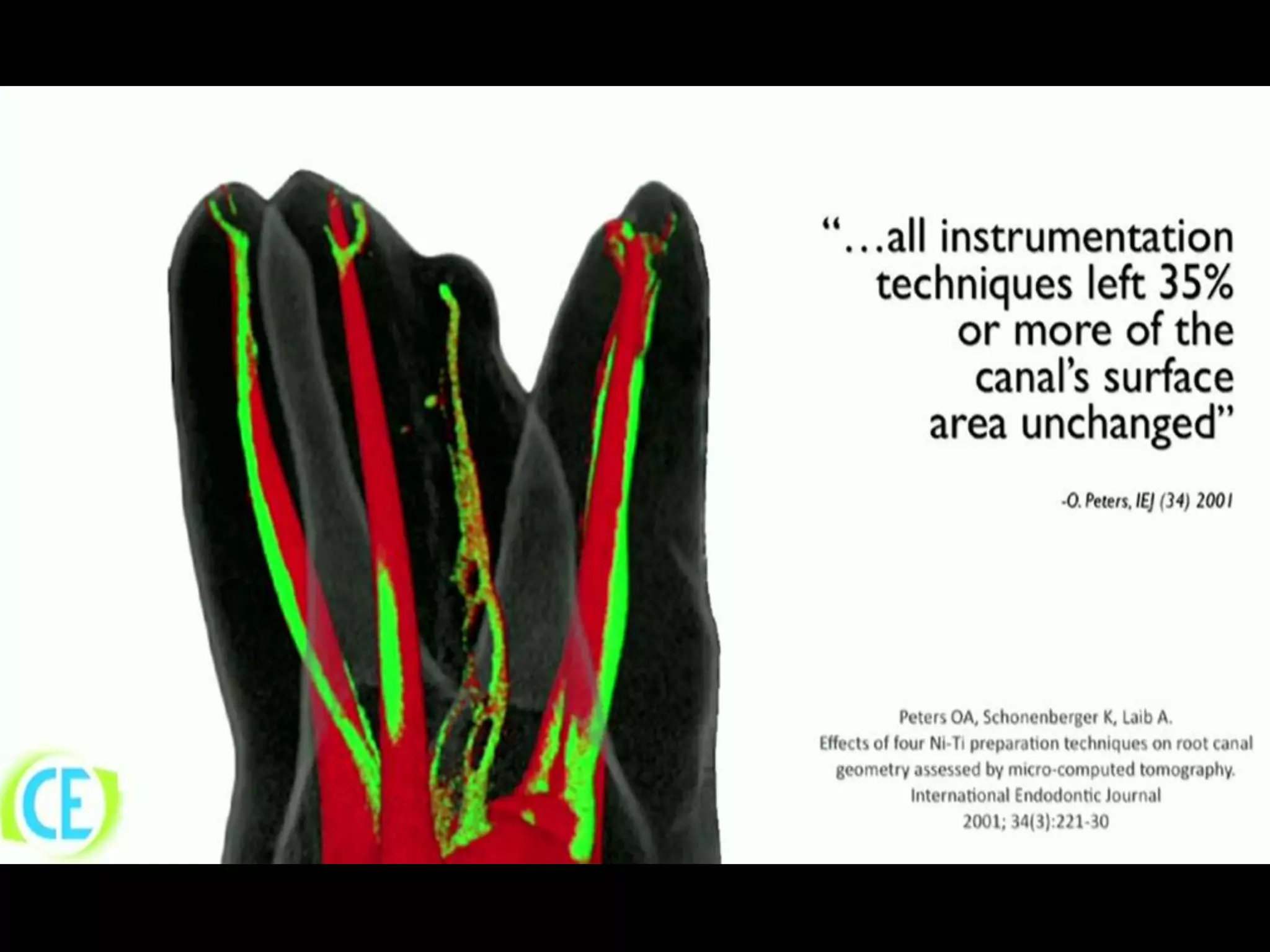 Irrigation in Endodontics.pdf