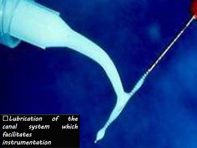 Irrigation in Endodontics.pdf | Dental Health | Diseases and Conditions