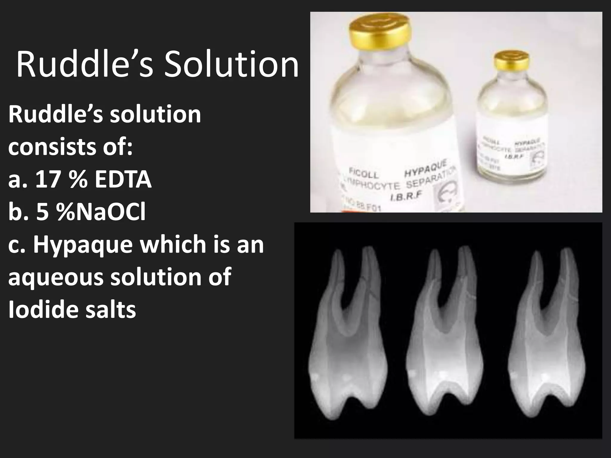 Endodontic Irrigation and root canal medicament the new methods of irrigation | PPTX