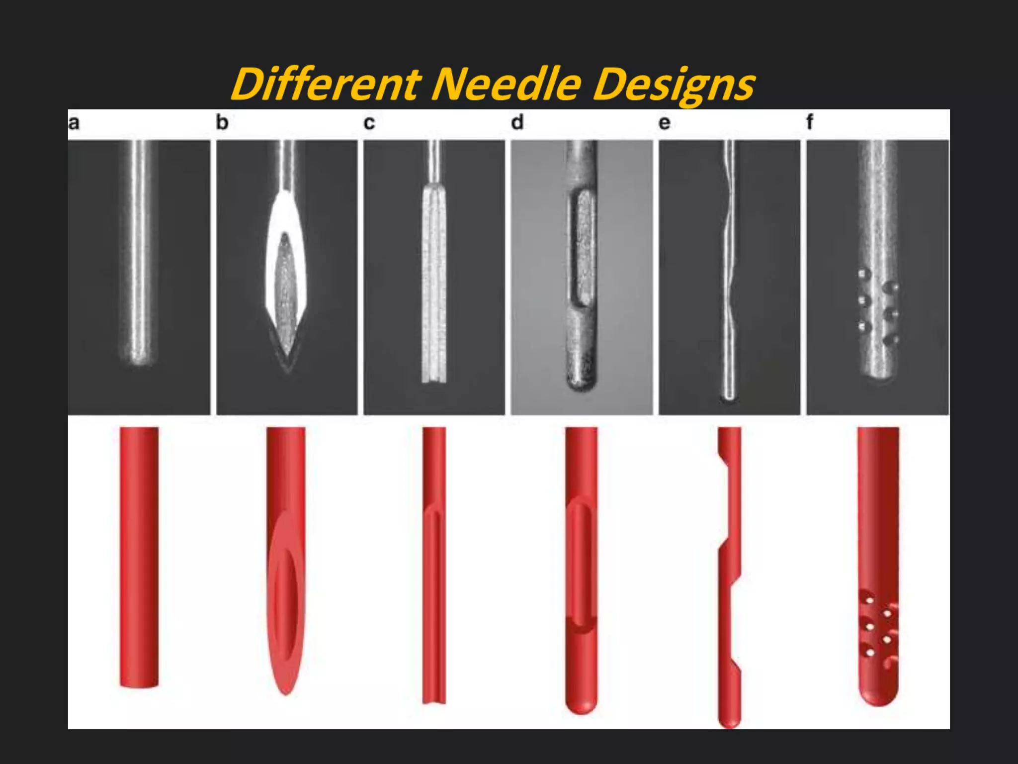 Endodontic Irrigation and root canal medicament the new methods of irrigation | PPTX