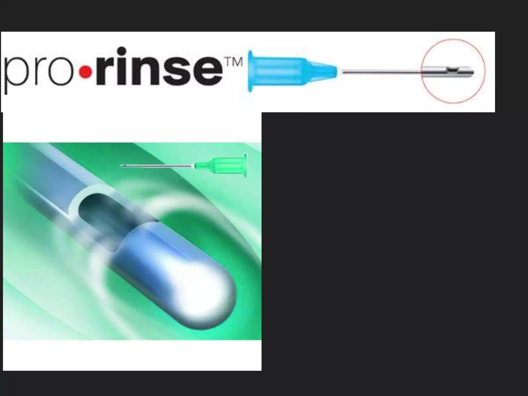 Endodontic Irrigation and root canal medicament the new methods of ...