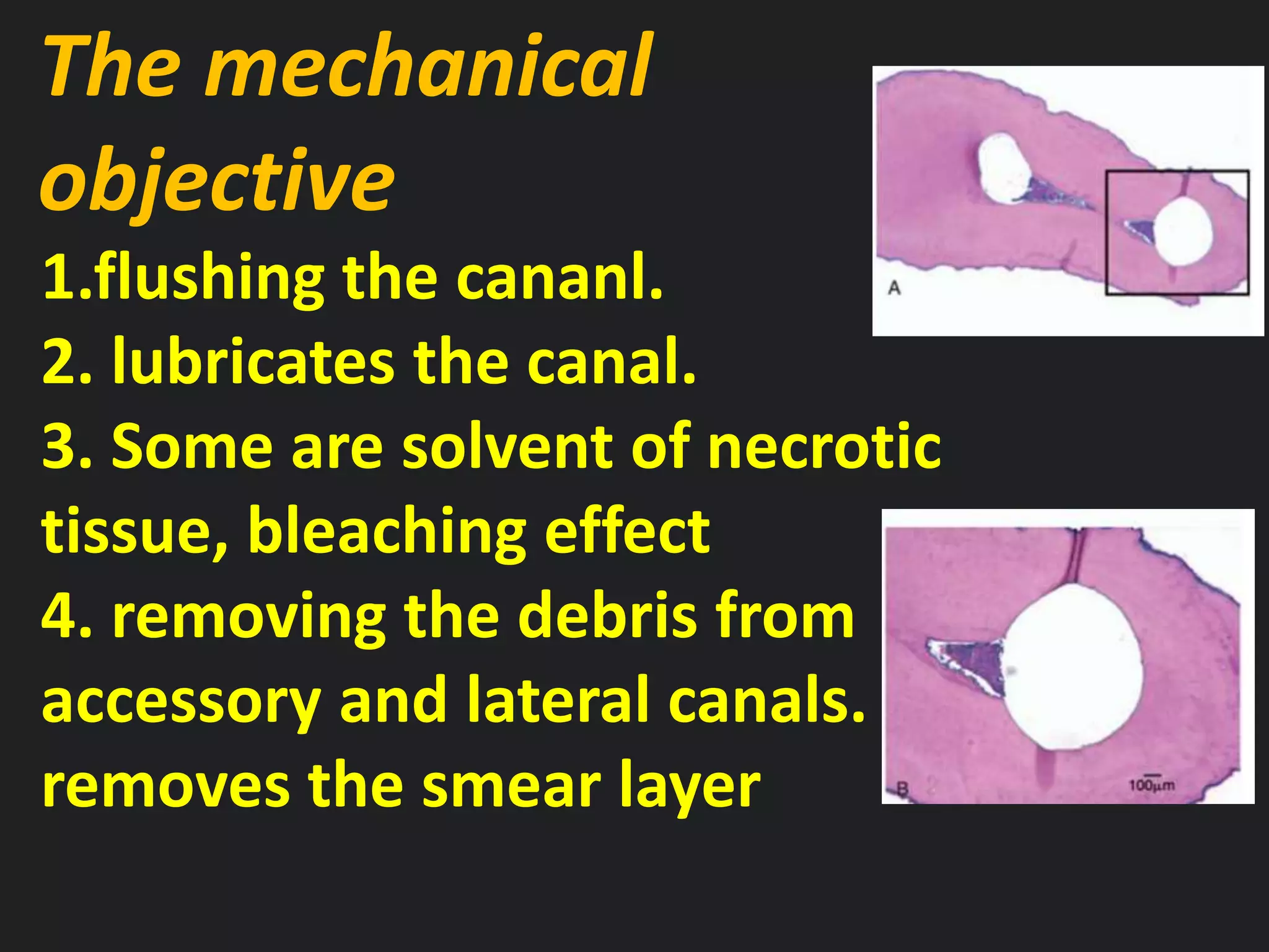 Endodontic Irrigation and root canal medicament the new methods of irrigation | PPTX