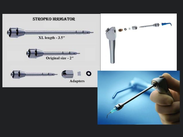 Endodontic Irrigation and root canal medicament the new methods of irrigation | PPTX
