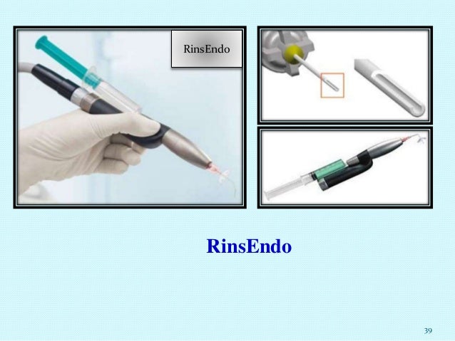 Irrigation techniques