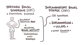 Irritable bowel syndrome | PPT