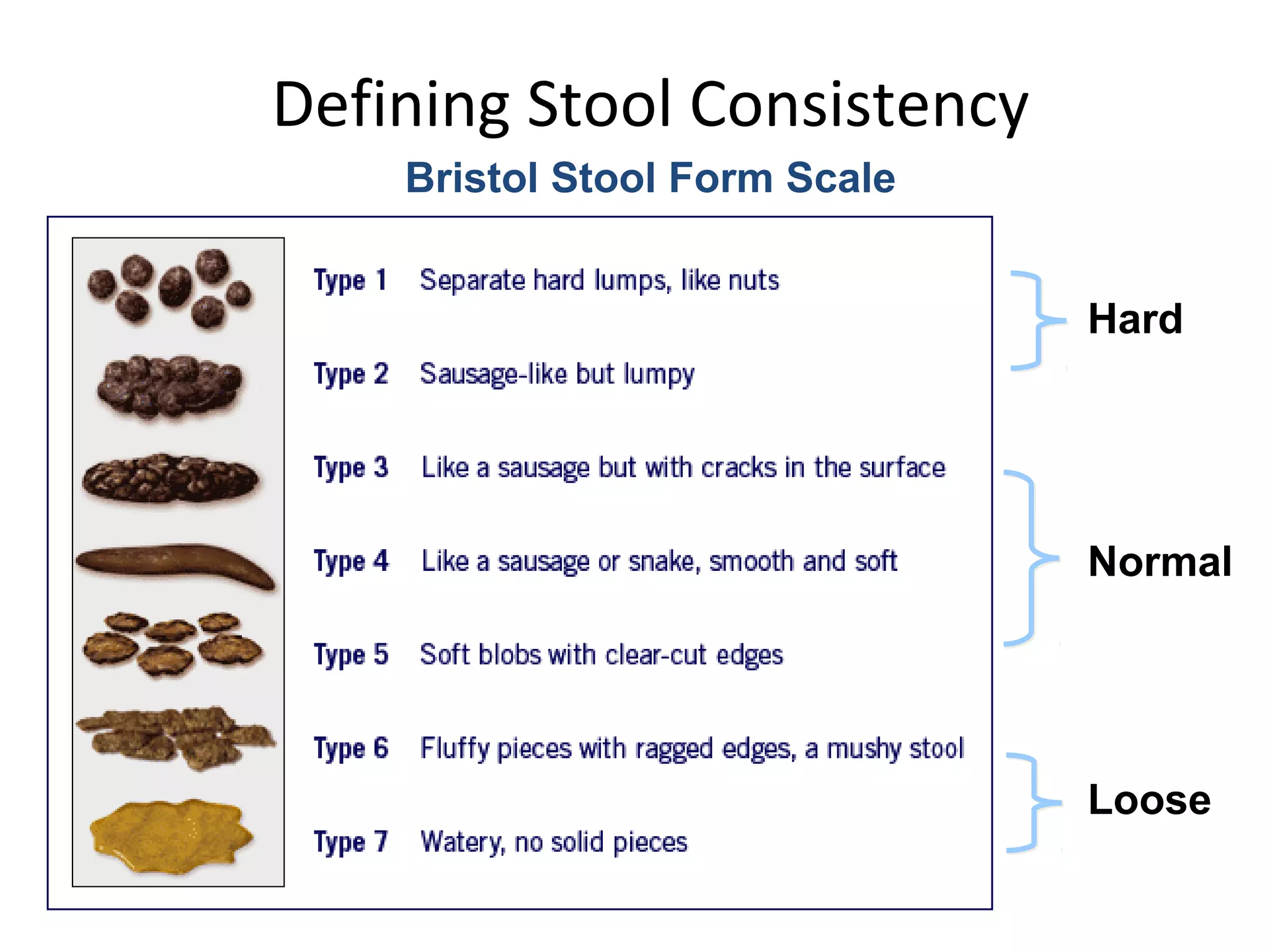 Irritable bowel syndrome | PPT