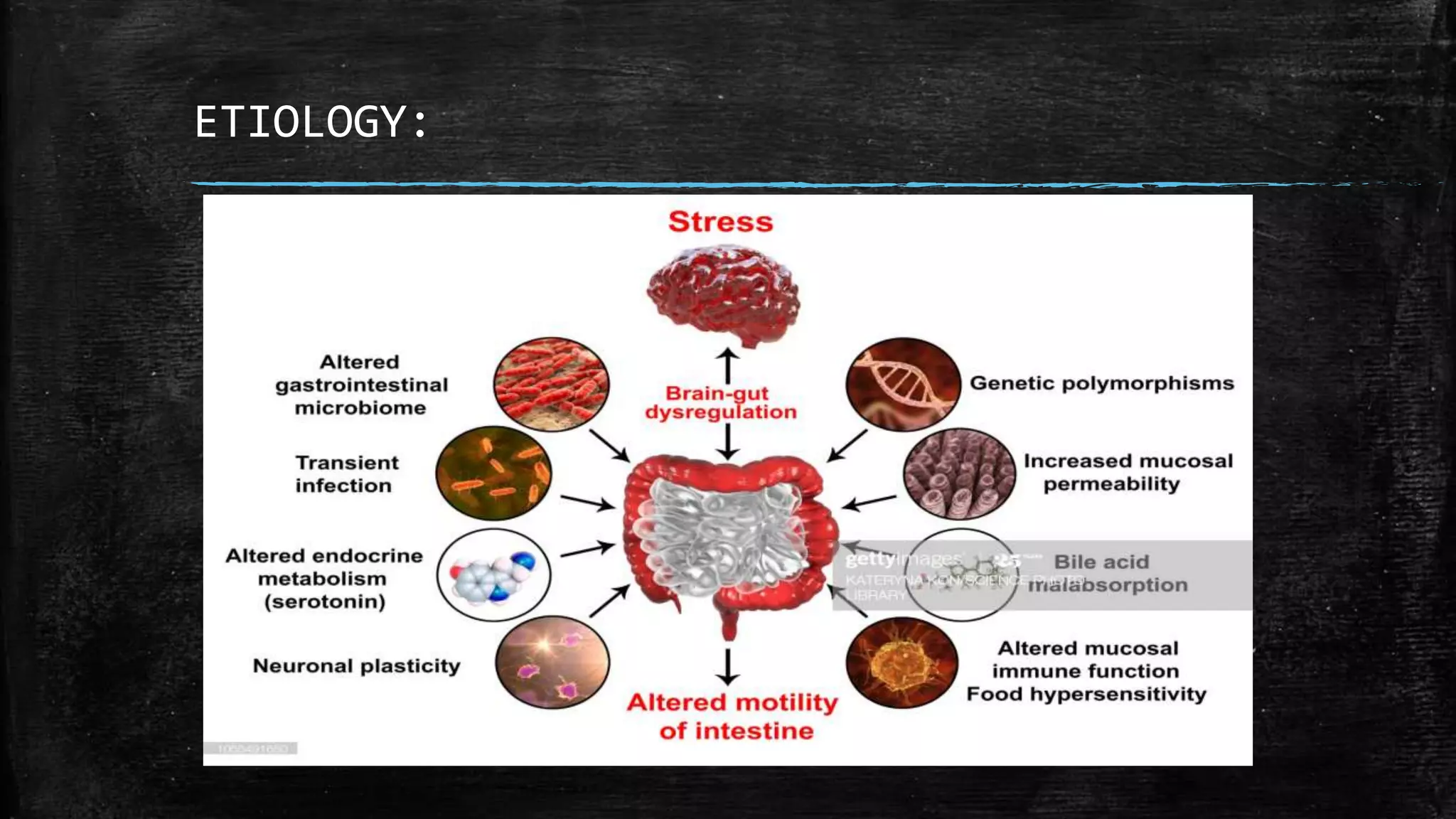 Irritable bowel syndrome, management, drugs | PPTX