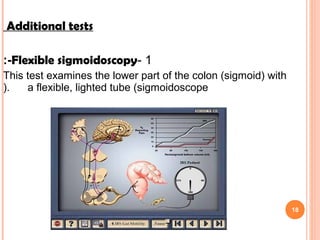 Irritable bowel syndrome | PPT