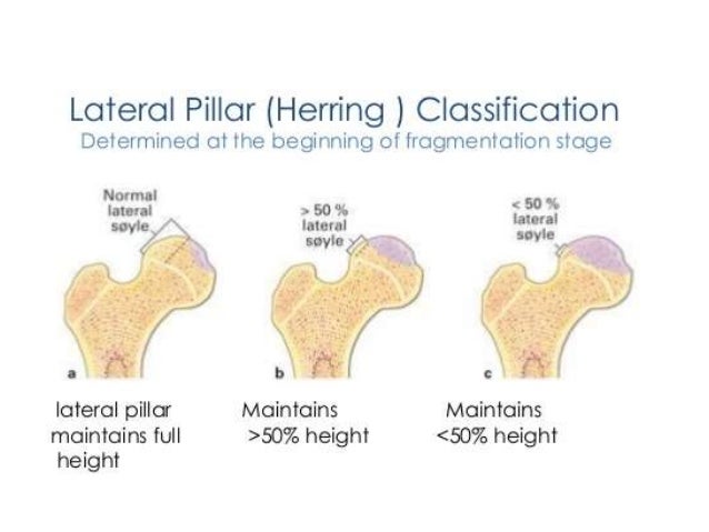 Irritable hip and perthe's disease