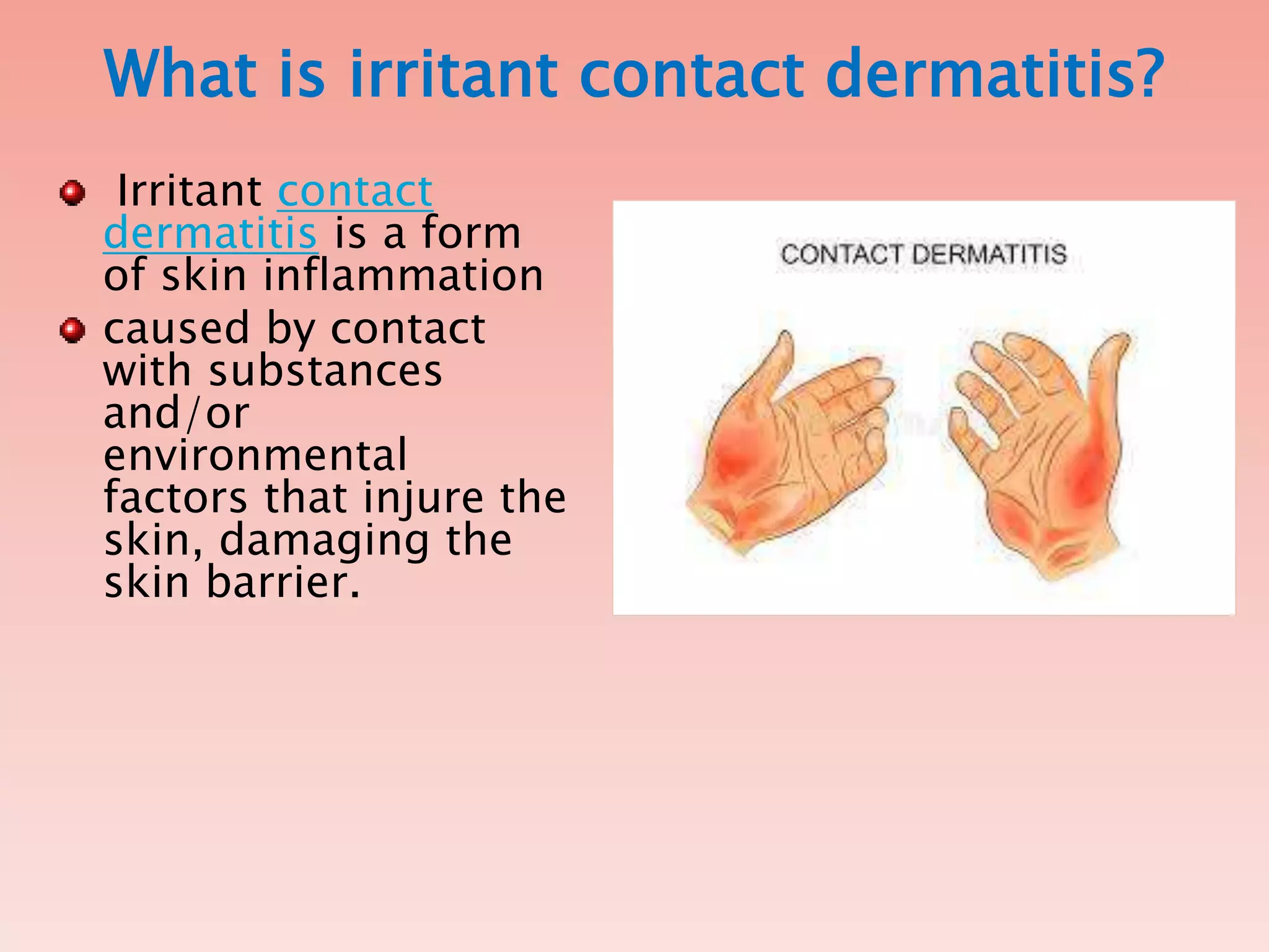 Irritant contact dermatitis by dr maria saeed | PPT