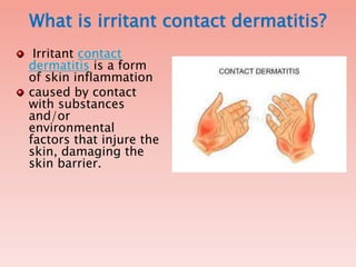 Irritant contact dermatitis by dr maria saeed | PPTX