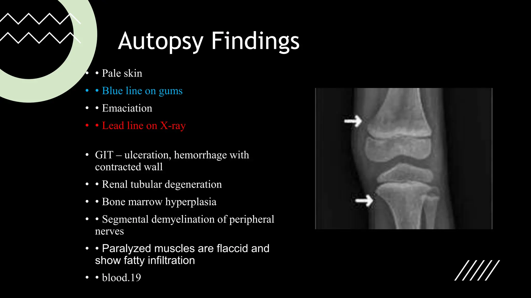 irritant poison final #poisoning # irritants # | PPTX | Digestive ...