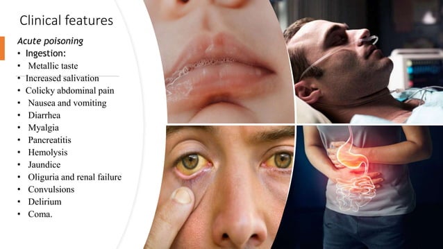 irritant poison final #poisoning # irritants # | PPTX | Digestive ...