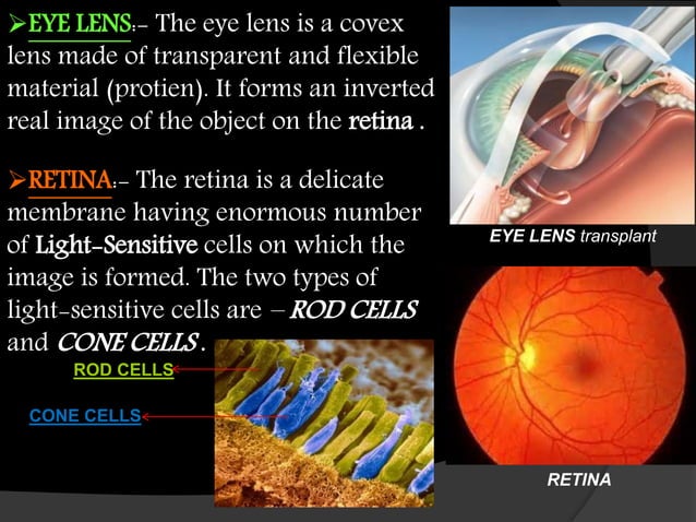 HUMAN EYE AND ITS DEFECTS | PPTX | Eye and Vision Conditions | Diseases ...