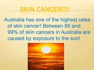 Isabelle and vanessas sunsmart powerpoint | PPTX | Skin and Dermatology ...