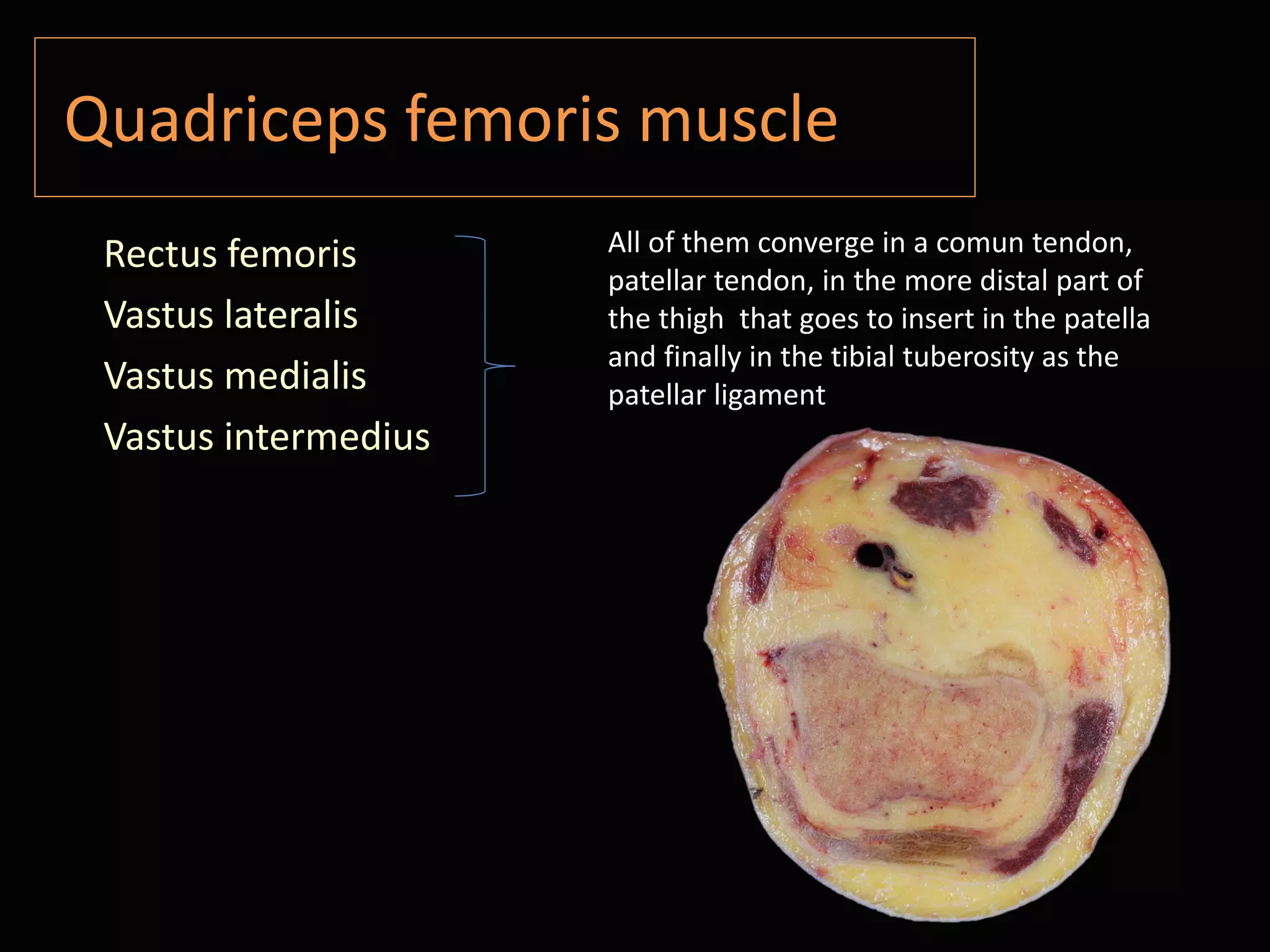 Isabel Miguel: Quadriceps muscle anatomy Cadaver study - PRP | PPT ...