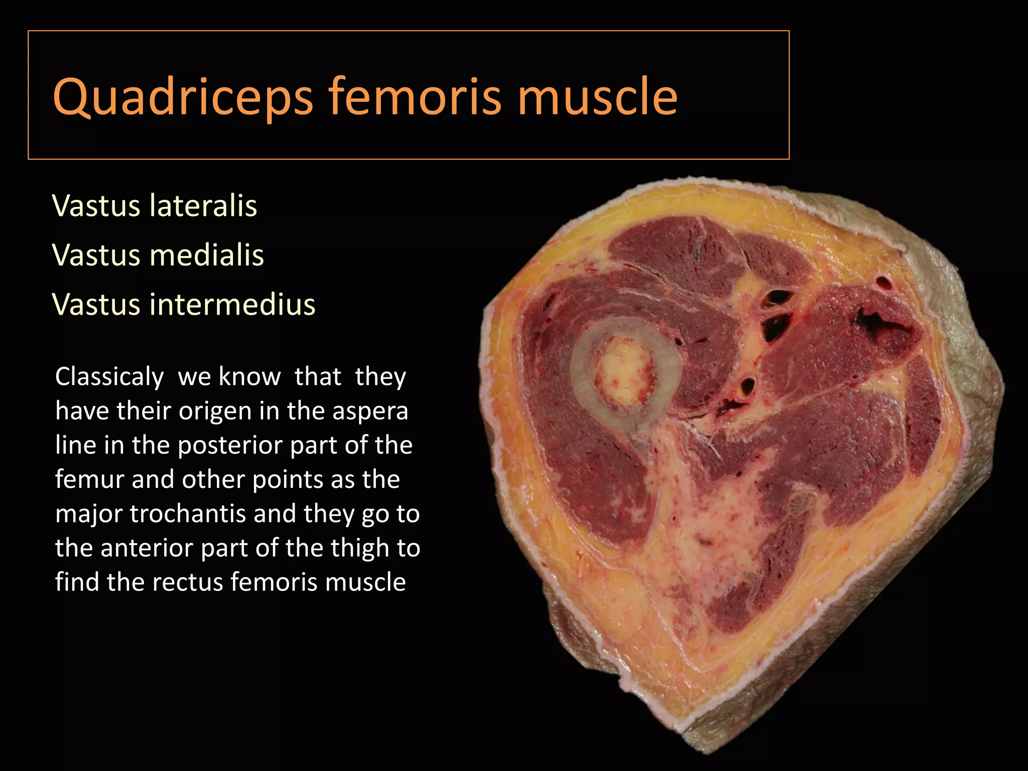 Isabel Miguel: Quadriceps muscle anatomy Cadaver study - PRP | PPT ...