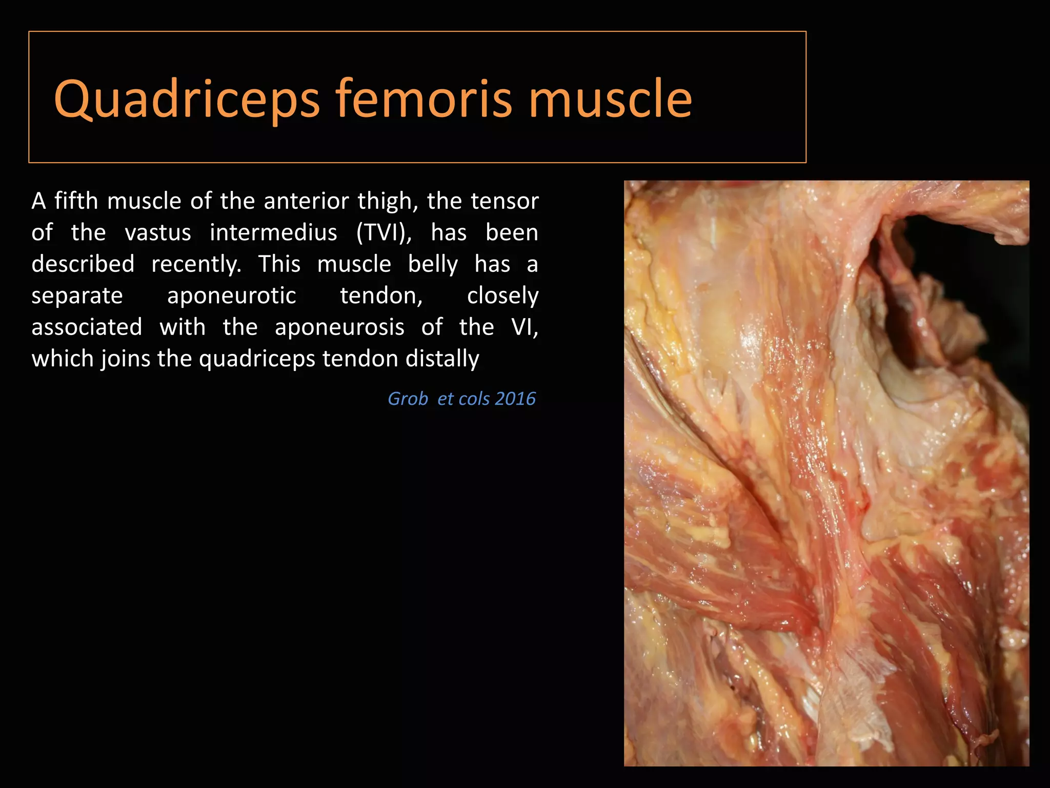 Isabel Miguel: Quadriceps muscle anatomy Cadaver study - PRP | PPT ...
