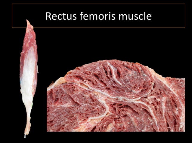 Isabel Miguel: Quadriceps muscle anatomy Cadaver study - PRP | PPT