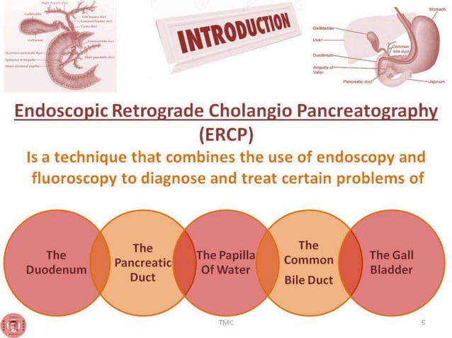 Anesthetic management of ERCP patient tushar chokshi | PPTX