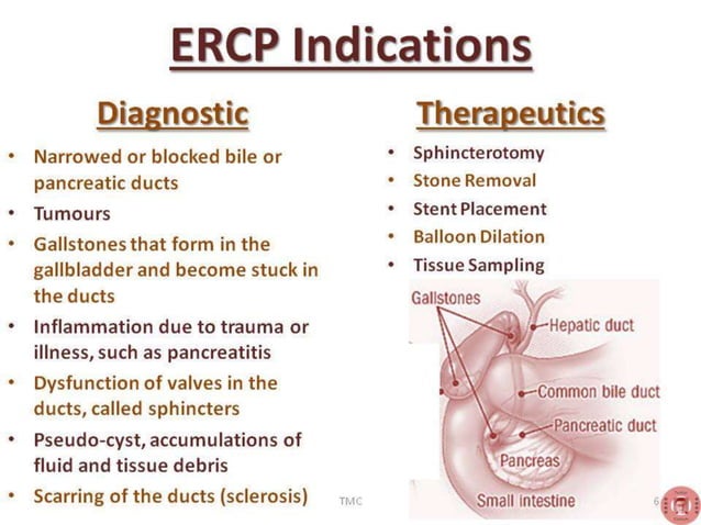 Anesthetic management of ERCP patient tushar chokshi | PPTX