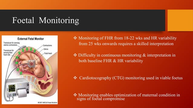Anesthesia For Non Obstetric Surgery In Pregnancy Ppt
