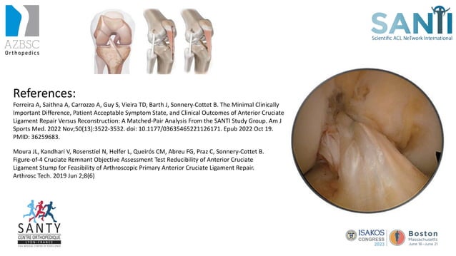ACL Repair Vs Reconstruction, AZBSC Orthopedics, Scottsdale, AZ | PDF